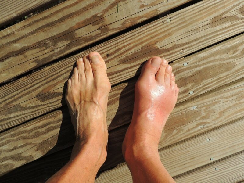 How to Fix Frequent Foot Pain Plus Prevent Problems ...